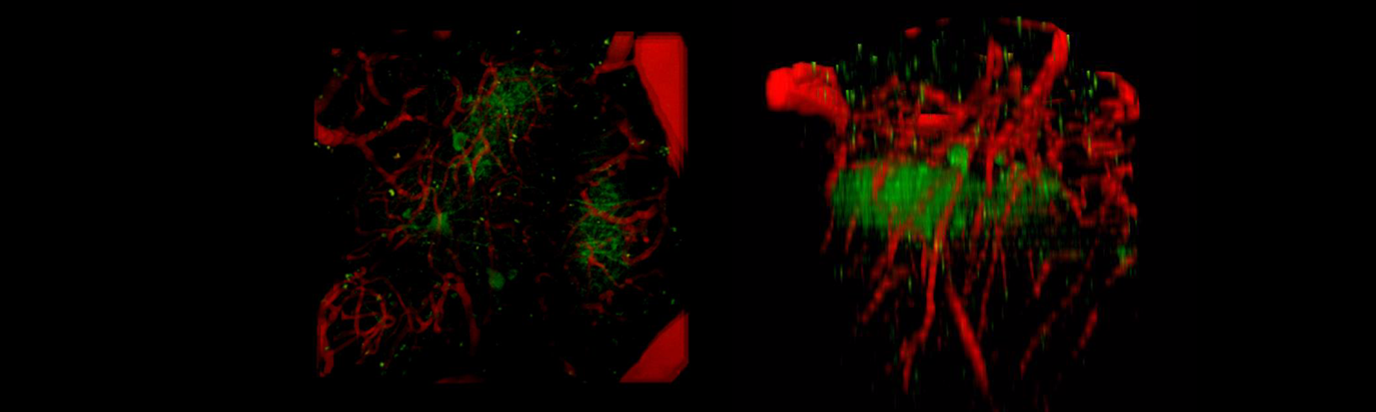 Three-photon imaging: How it works