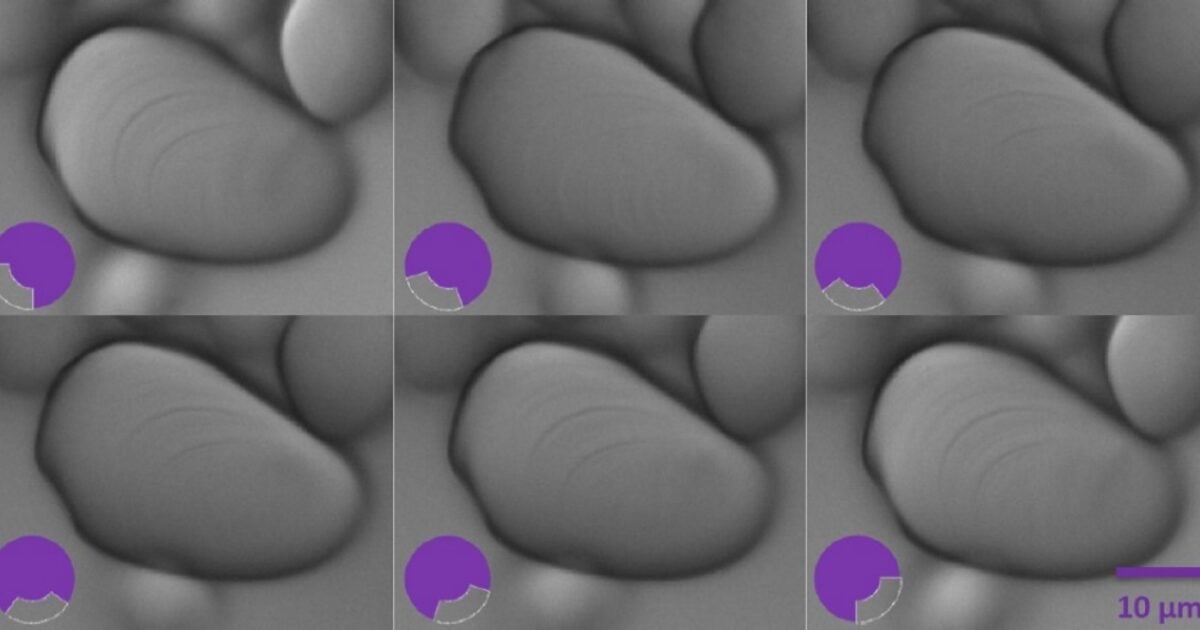A guide to Dodt Gradient Contrast | Scientifica