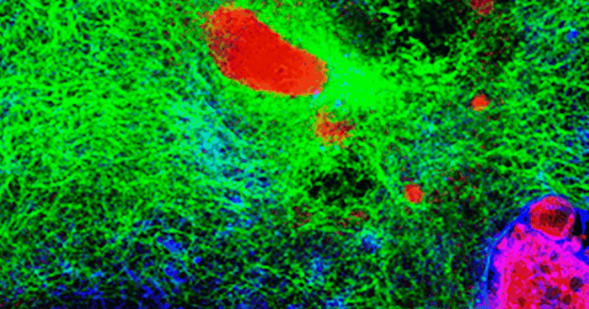 Fluorescence light sources: A comparative guide | Scientifica