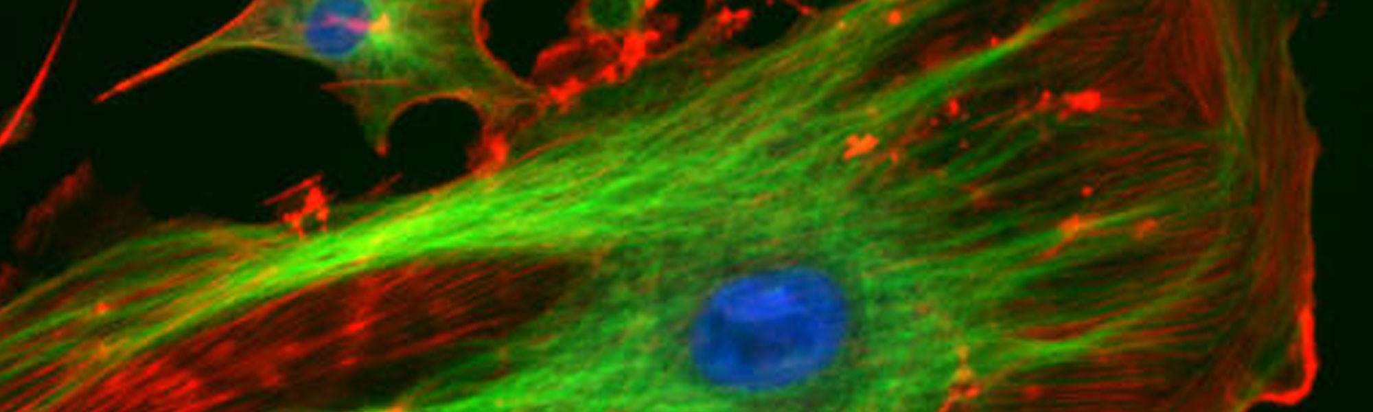 The future of optogenetics...