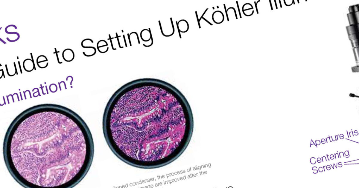#LabHacks: Six Step Guide to Setting Up Köhler… | Scientifica