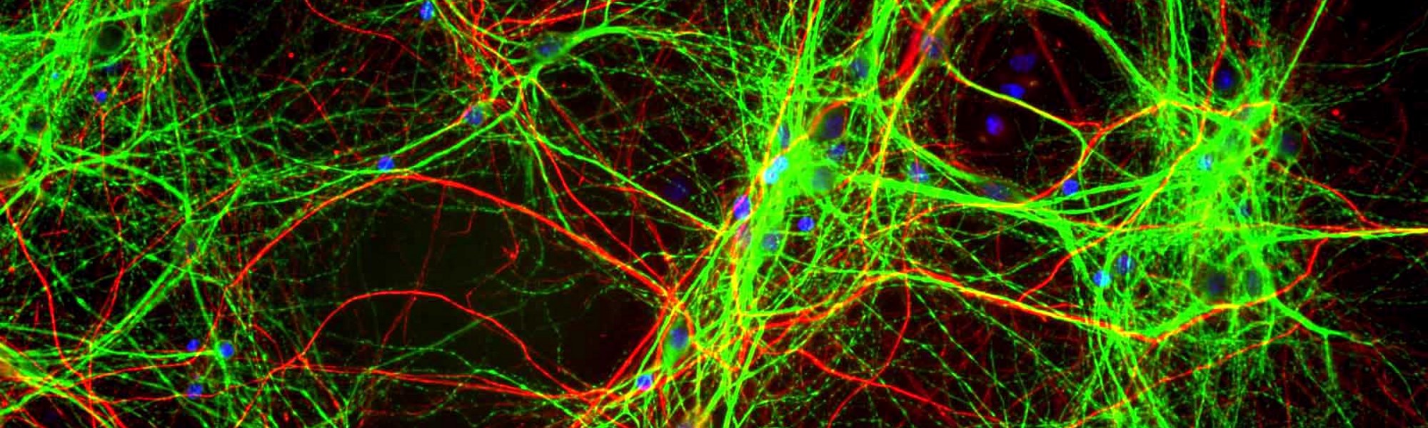 Using the SliceScope Pro 2000 for in vitro electrophysiology experiments