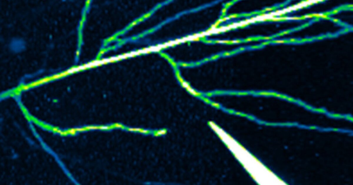 Memory encoding: Synaptic plasticity requires specific… | Scientifica