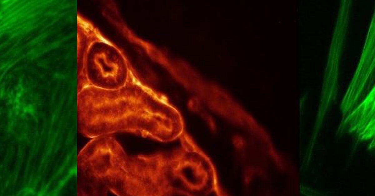 Widefield fluorescence microscopy: What you need to know | Scientifica