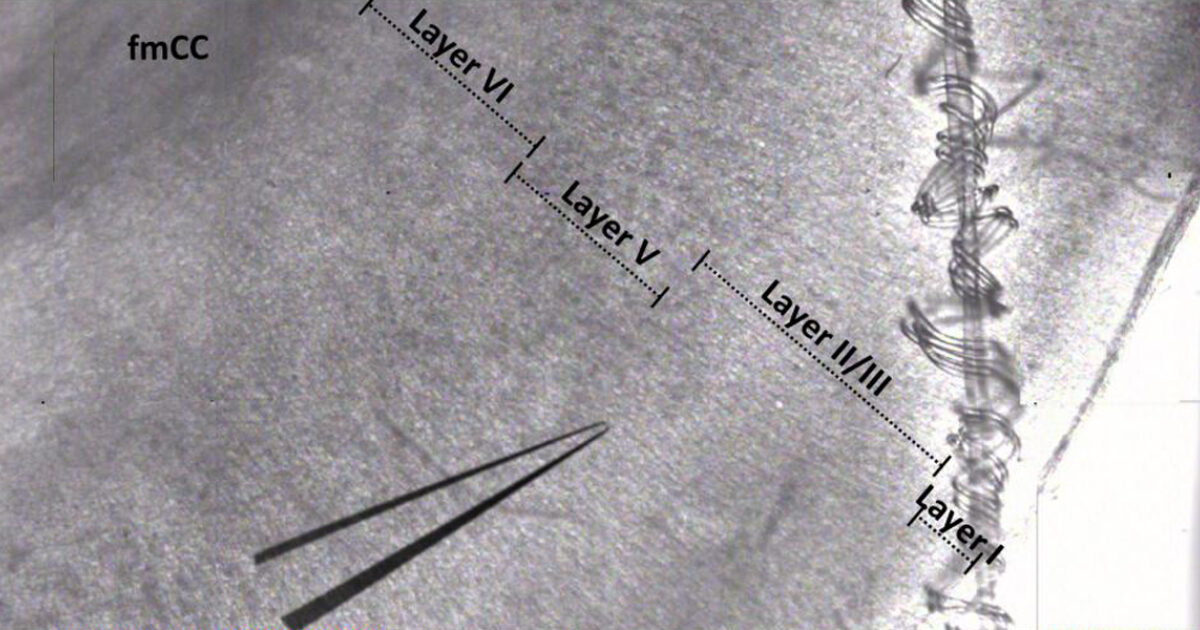 A guide to stitching images using Micro-Manager and… | Scientifica