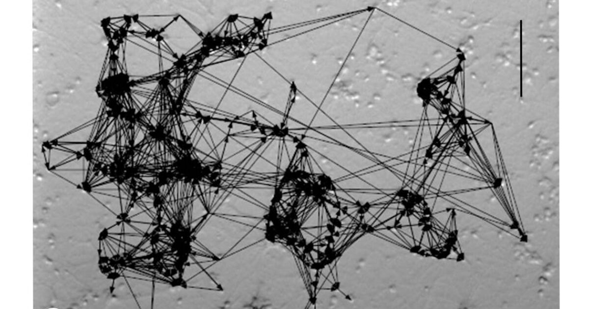 Using a SliceScope to combine calcium imaging and laser… | Scientifica